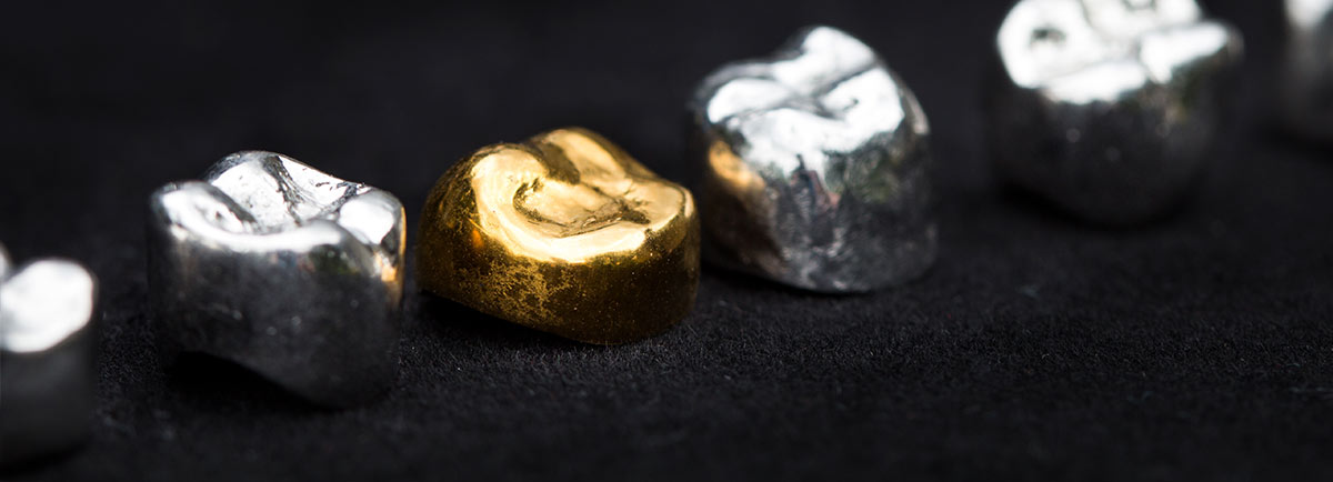 Zahngold – Goldankauf Vaihingen Enz für Edelmetalle aller Art von ...